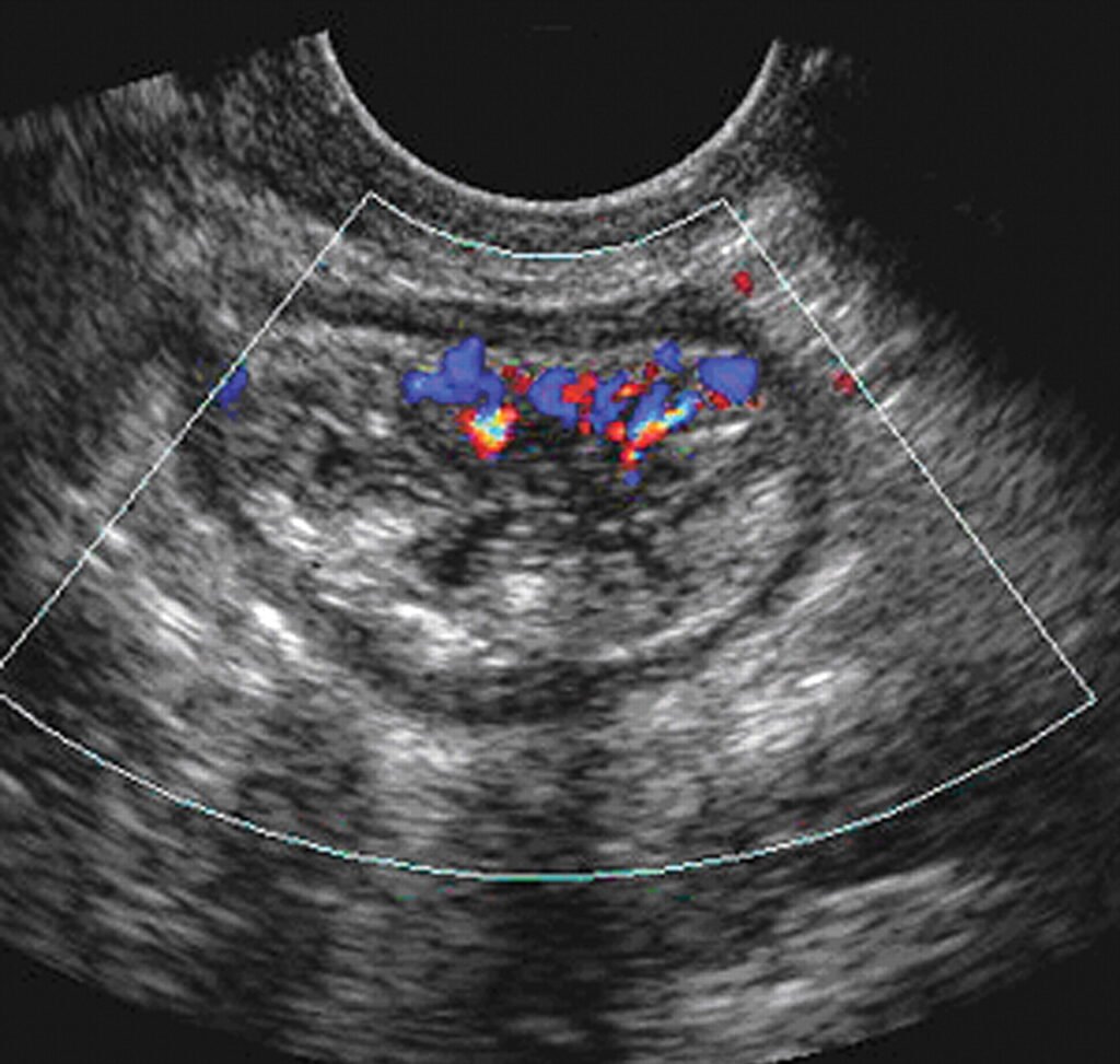 Small Parts/Transvaginal/Transrectal USG - Noble Imaging And Diagnostics